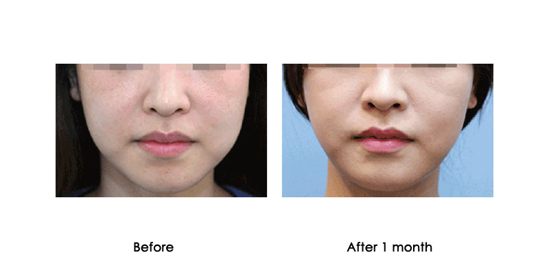 KABELLINE – Aesthetic Leader